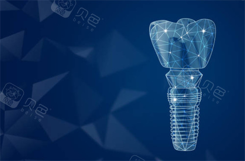 详细解析：士卓曼BLX和BLT有何区别？blx植体强度高微创|blt种植体规格多适应性广泛！ - 贝色口腔